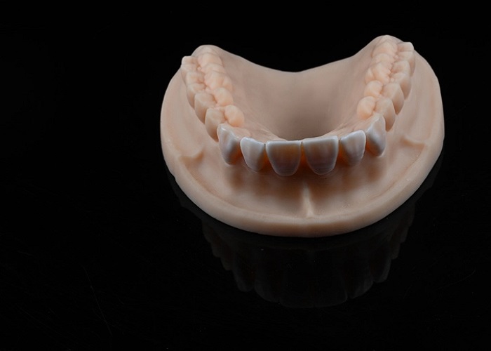 Digital Wax Up Dental: Key Steps to Optimizing Patient Treatment ...