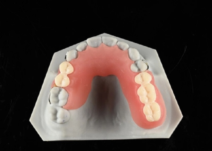 3D-Printed Denture: Reshaping Oral Health - Golden Smile Dental Lab