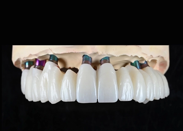 How Do Golden Smile Dental Products Contribute to Oral Health? - Golden ...